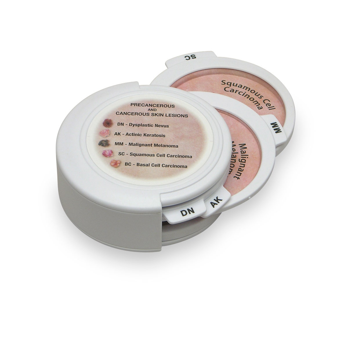 5-Piece Hinged Skin Cancer Disk Set - Nasco Education